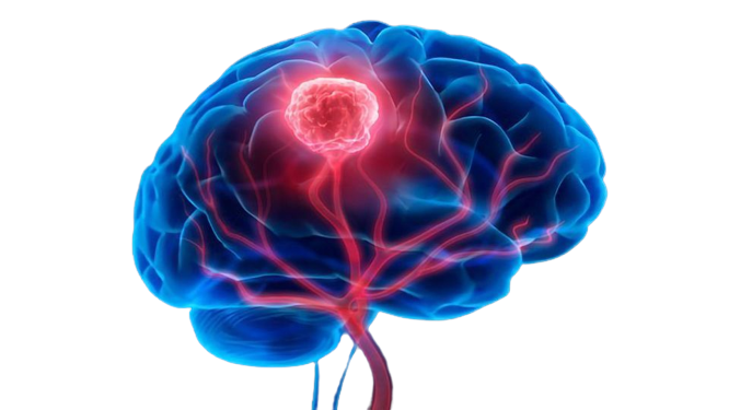 Brain tumor detection